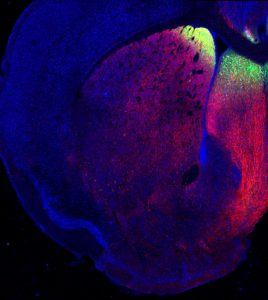 Brain, Computation, and Data Science